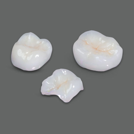 Camouflage® Composite Restorations - Smith-Sterling Dental Laboratories